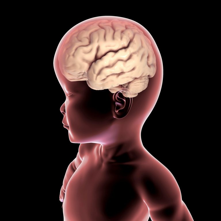 Microcefalia e Macrocefalia - Dra. Raquel Rodrigues - Neurocirurgia ...