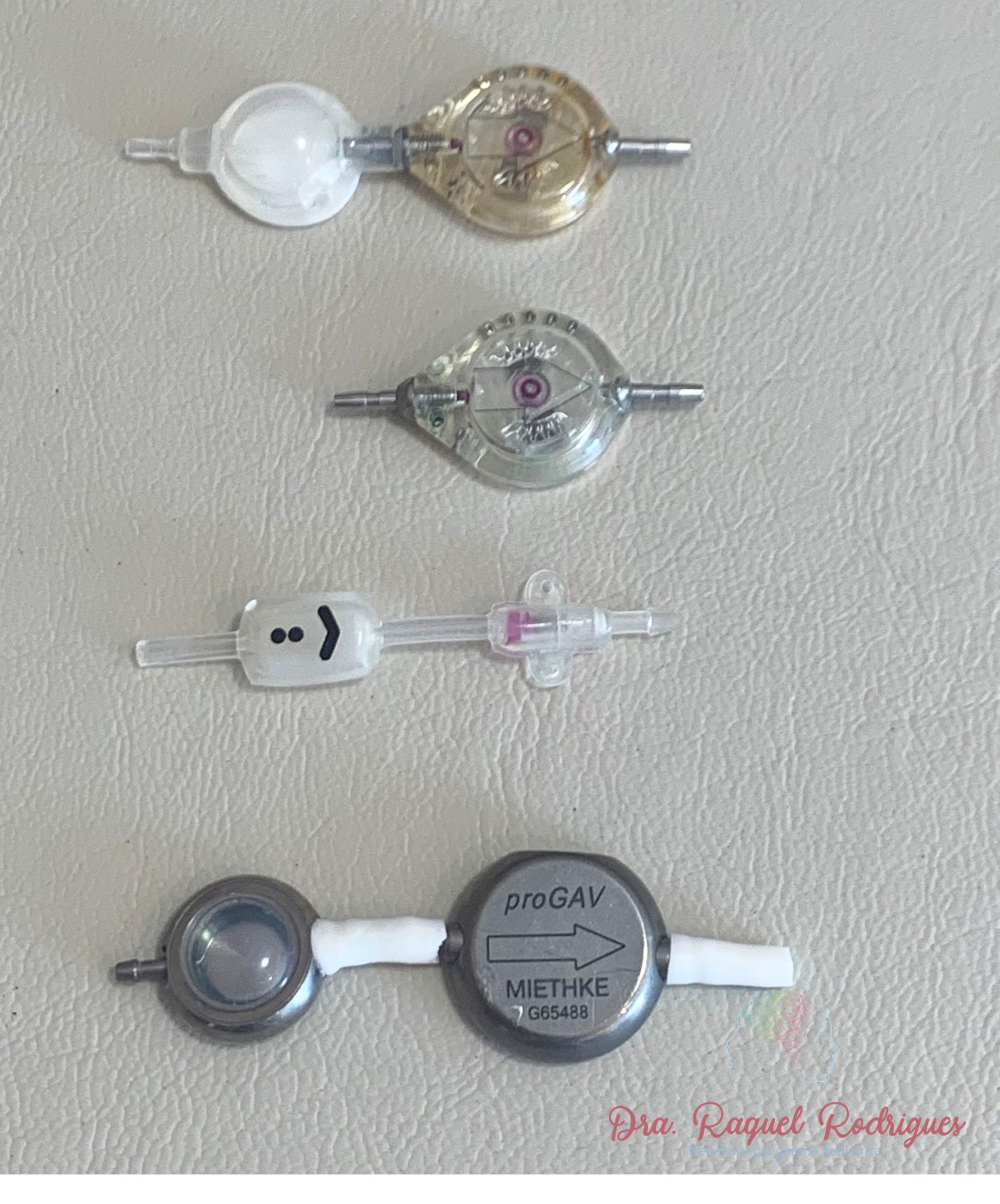 Hidrocefalia de Pressão Normal - Hidrocefalia do Idoso - Dra. Raquel Rodrigues - Neurocirurgia ...