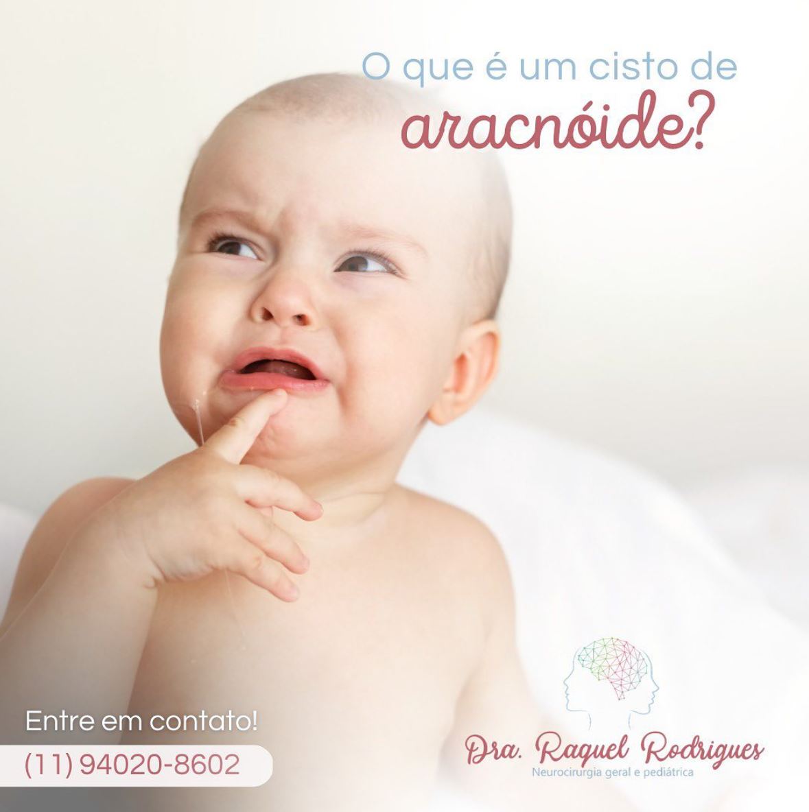 O que é cisto aracnóide - Dra. Raquel Rodrigues - Neurocirurgia pediátrica