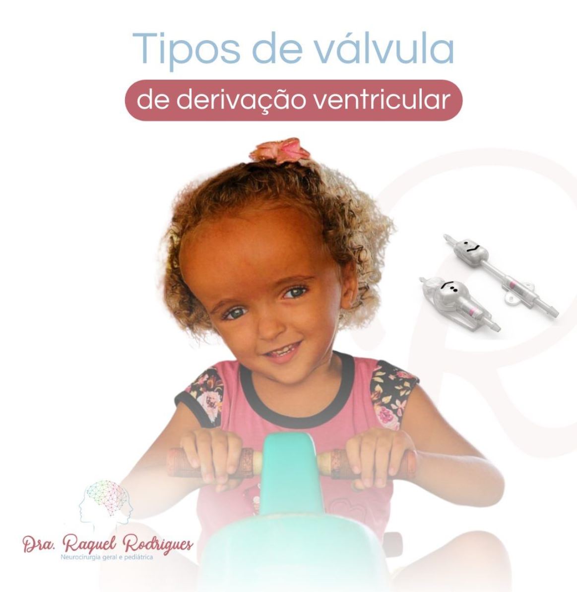 Importância dos tipos de válvula de DVP - Dra. Raquel Rodrigues ...