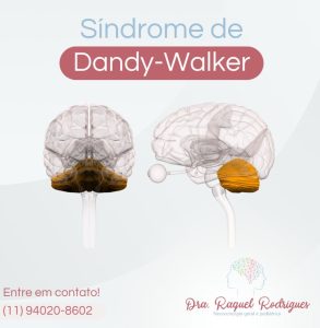 O que é síndrome de dandy-walker? - Dra. Raquel Rodrigues ...